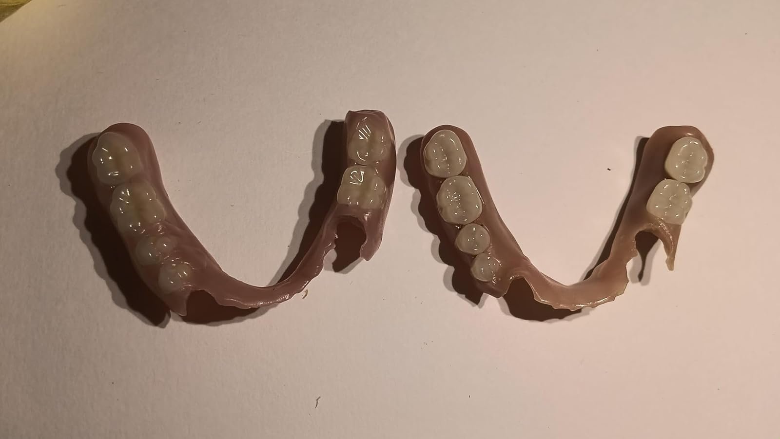A Real DIY Denture Kit Experience: What It Took to Make Dentures at Home