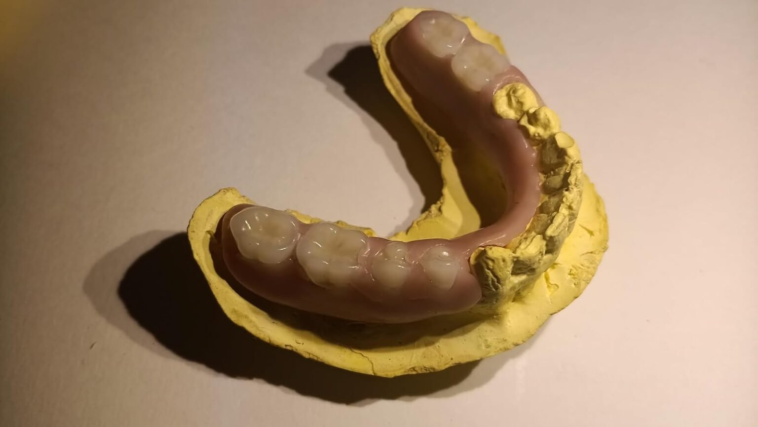 A Real DIY Denture Kit Experience: What It Took to Make Dentures at Home